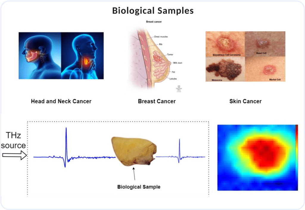 Terahertz-Based Real-Time Tissue Imaging Device for Surgical